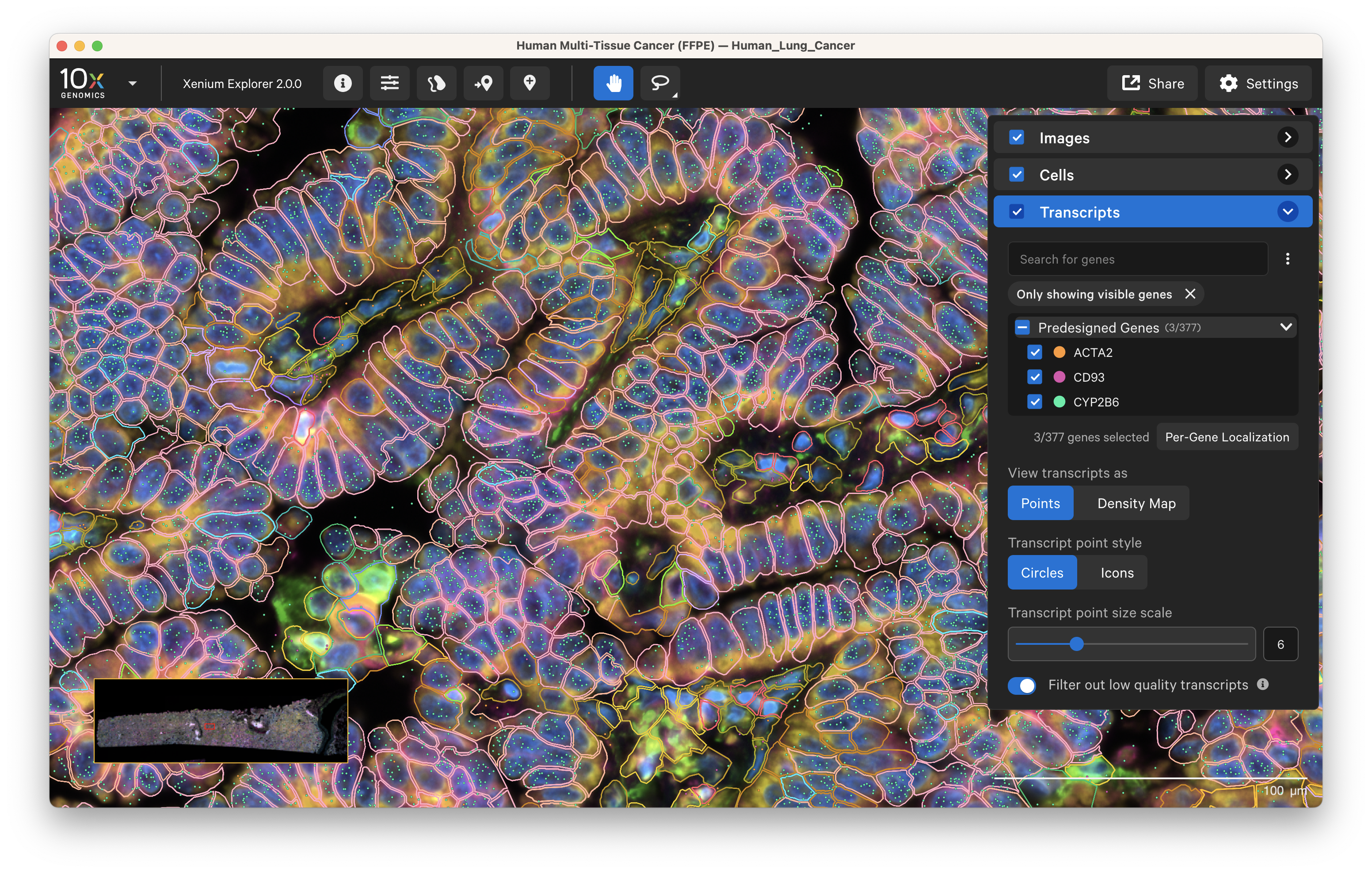 Optimizing your spatial transcriptomics research with Visium HD and Xenium Prime 5K - 10x Genomics